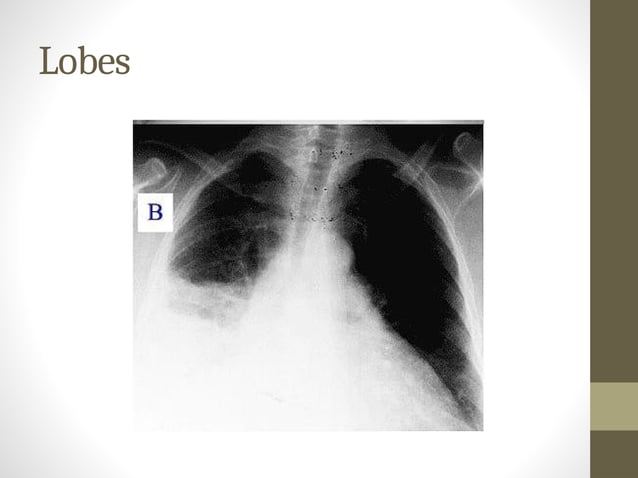PulmonarySldes [MedicalBooksVN.com] (1).pptx