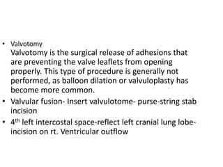 Pulmonary stenosis | PPTX