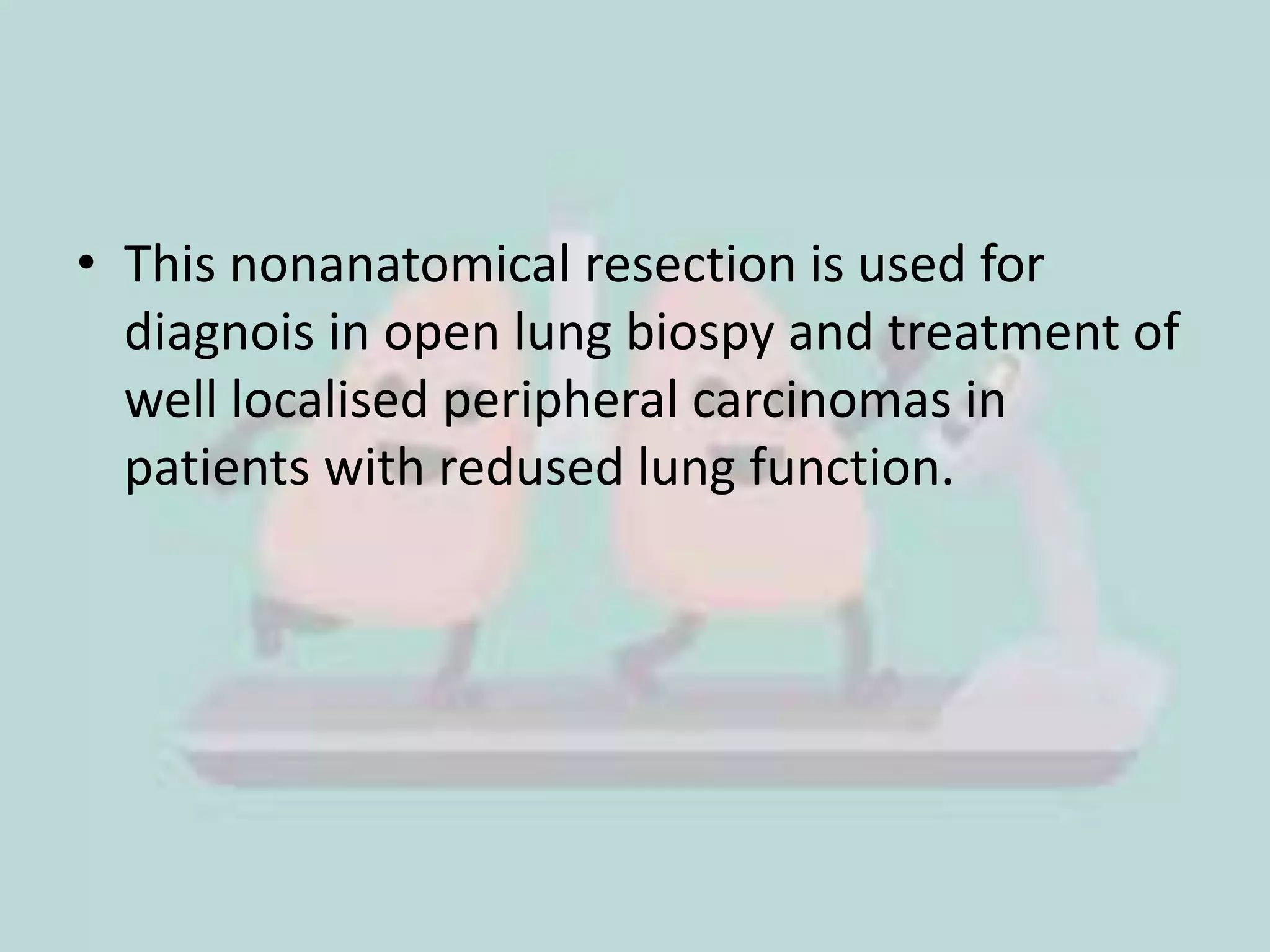 Pulmonary surgeries | PPTX