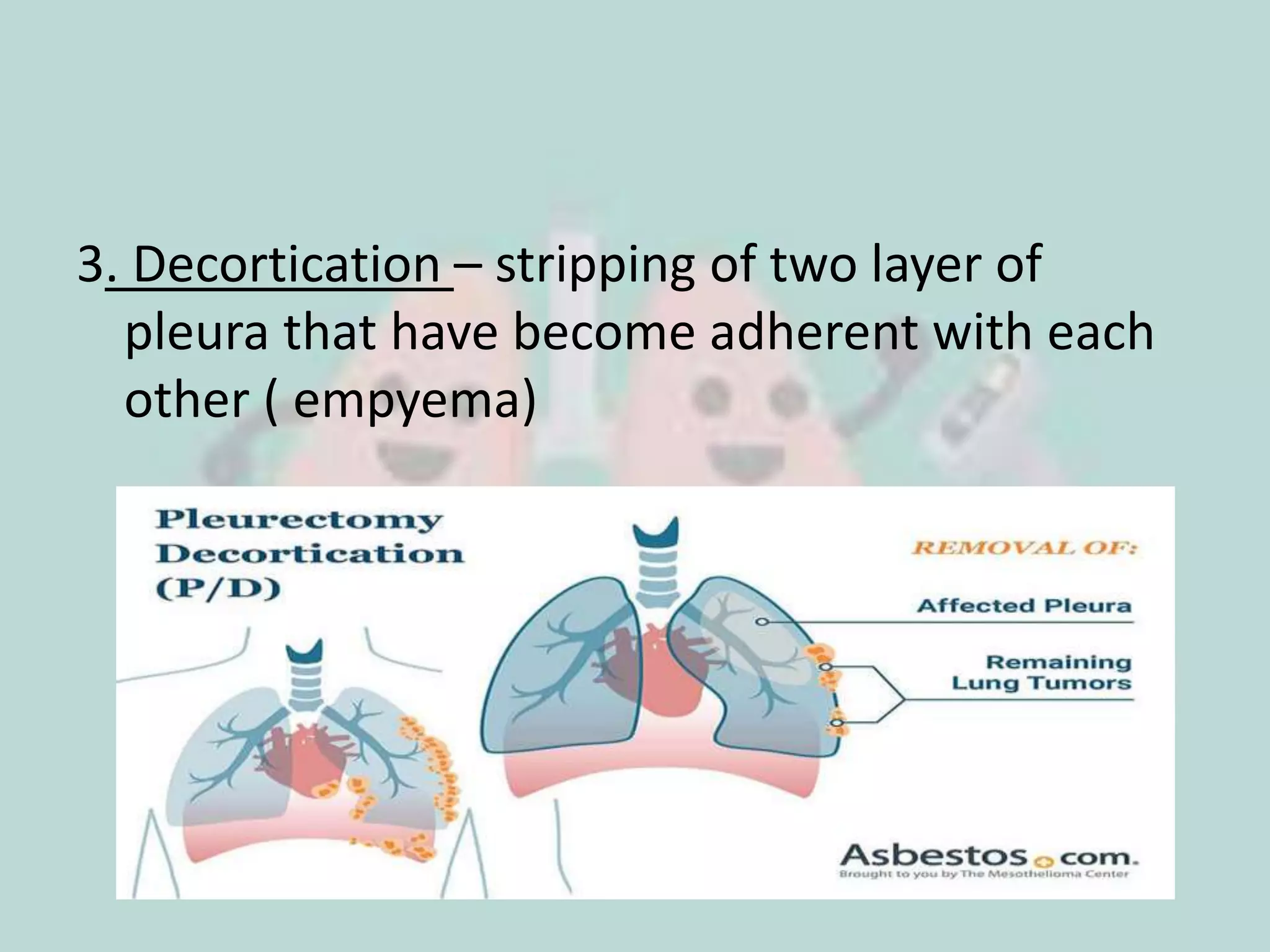 Pulmonary surgeries | PPTX