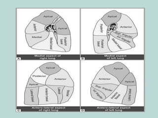 Pulmonary surgeries | PPTX