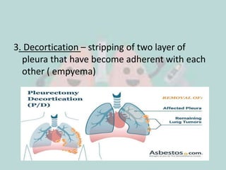 Pulmonary surgeries | PPTX
