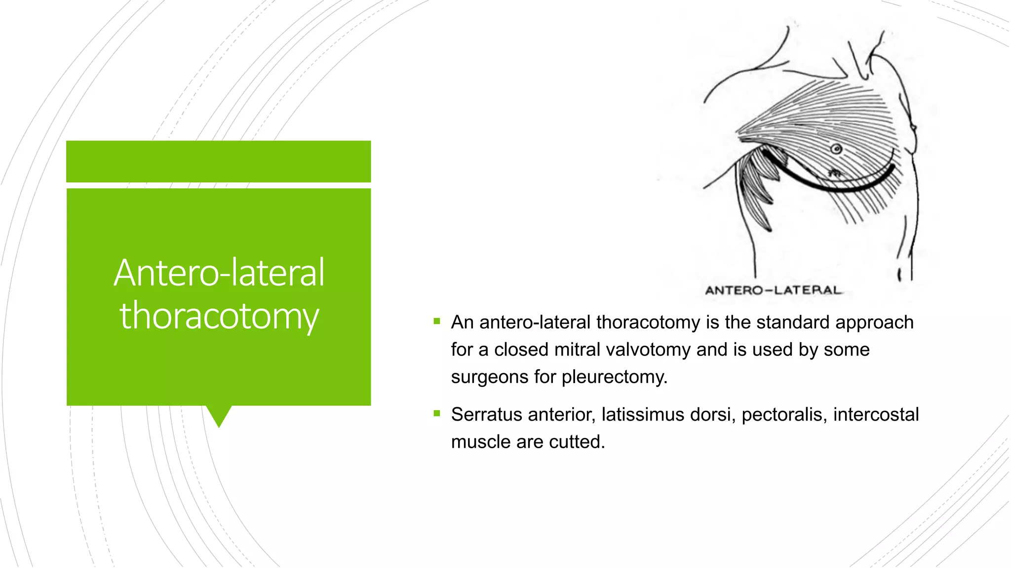 Physiotherapy in pulmonary_surgery[1].pptx