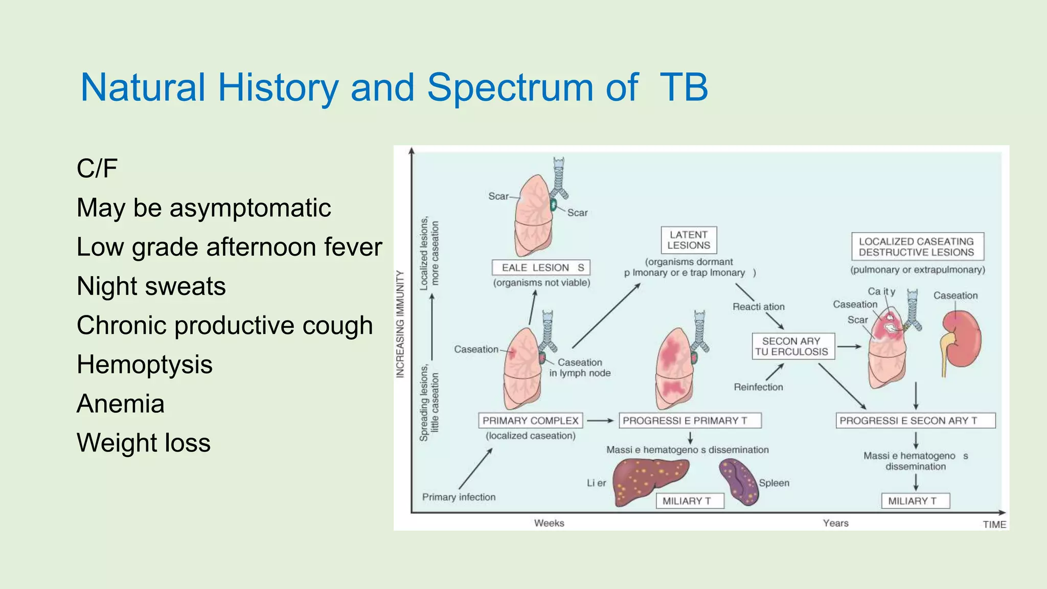 Pulmonary tb lec & practical | PPTX