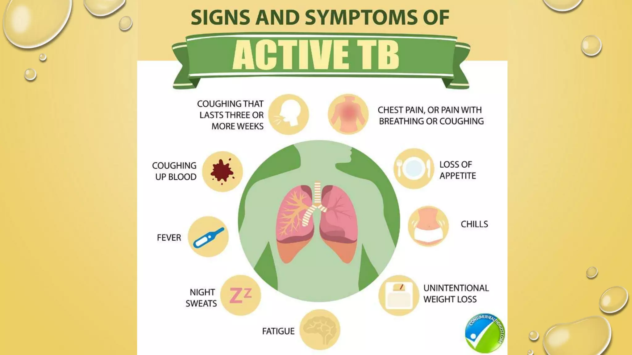 Pulmonary TB (Tuberculosis) PPT SlideShare | PPTX