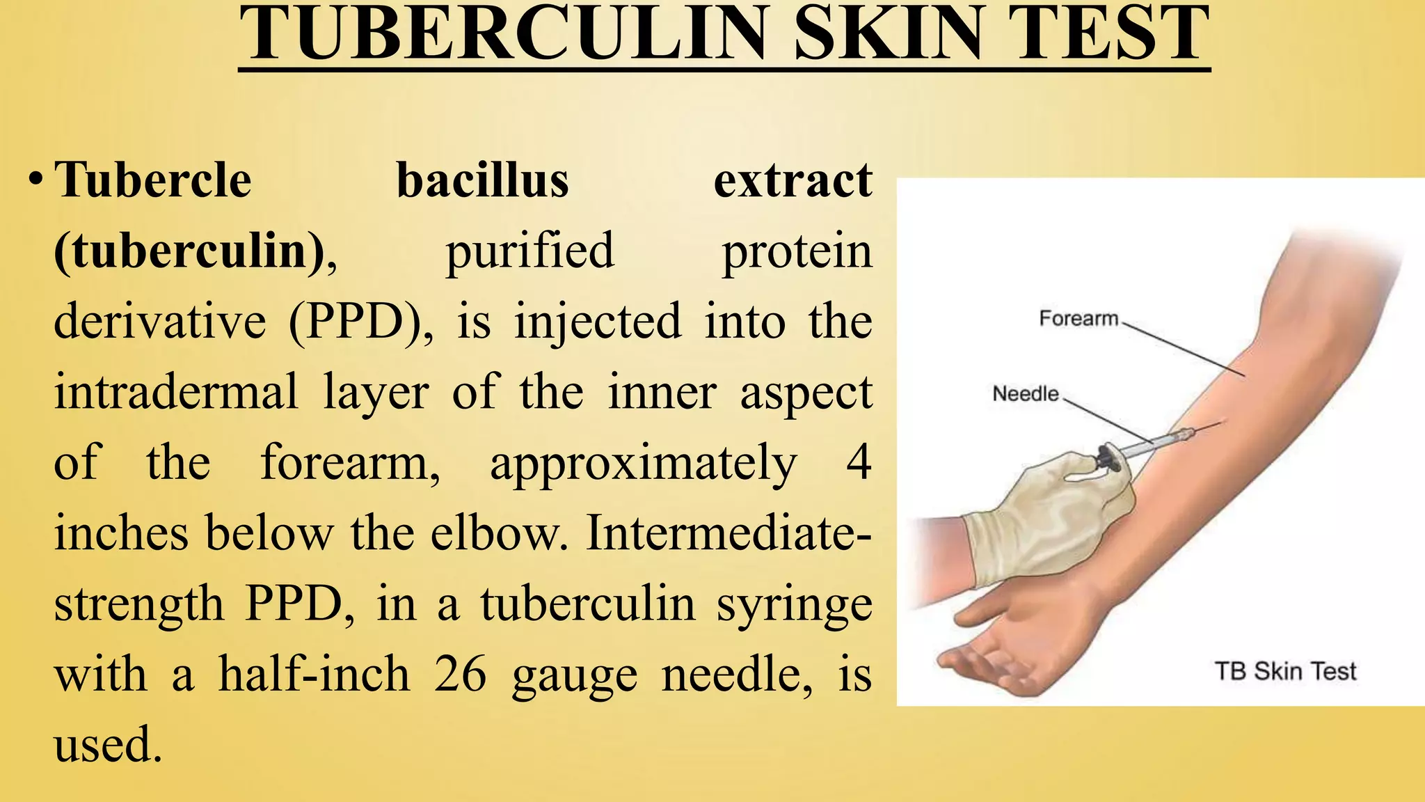 Pulmonary TB (Tuberculosis) PPT SlideShare | PPTX
