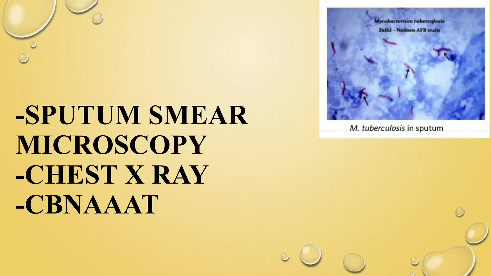 Pulmonary TB (Tuberculosis) PPT SlideShare | PPTX