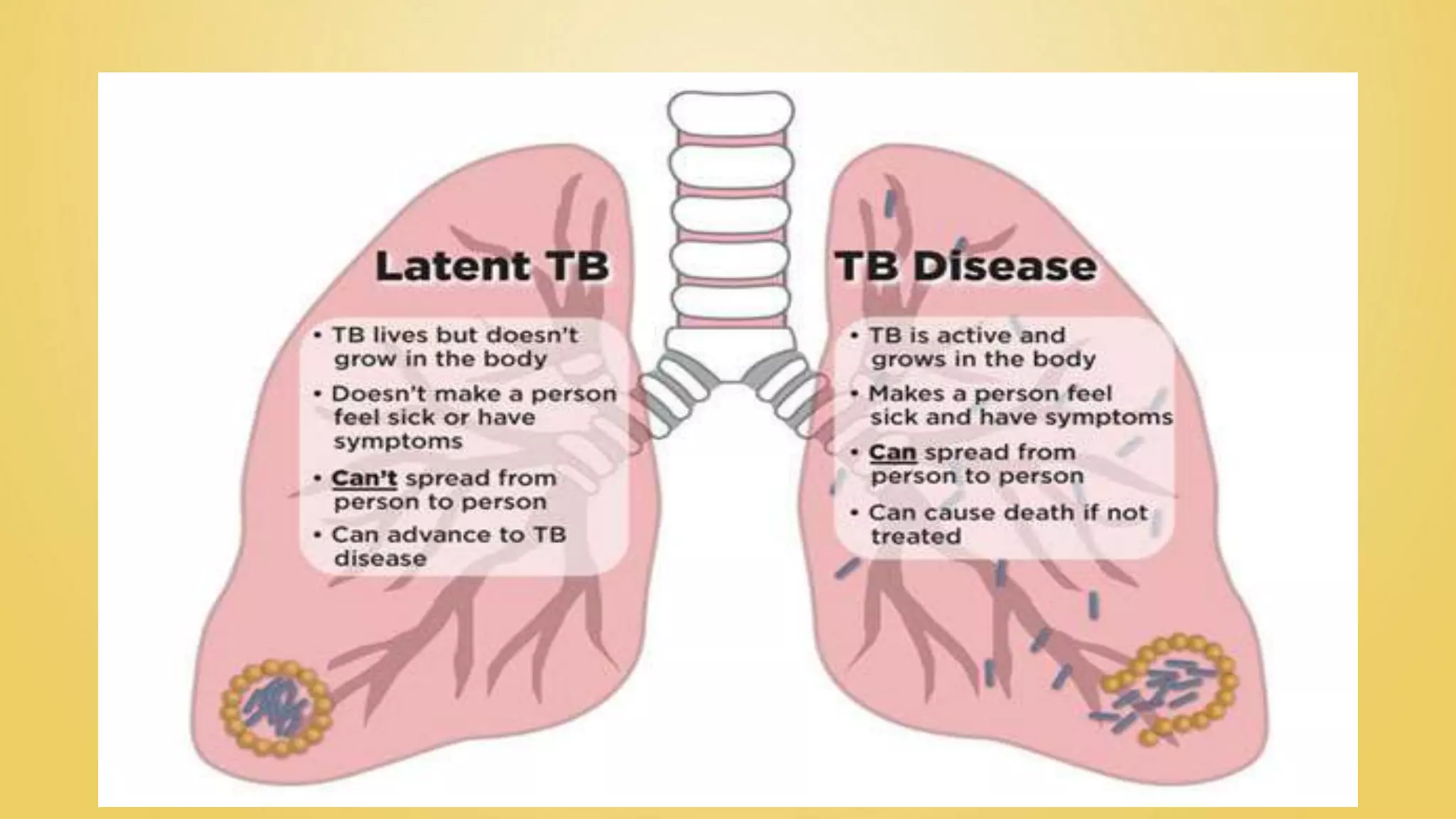 Pulmonary TB (Tuberculosis) PPT SlideShare | PPTX