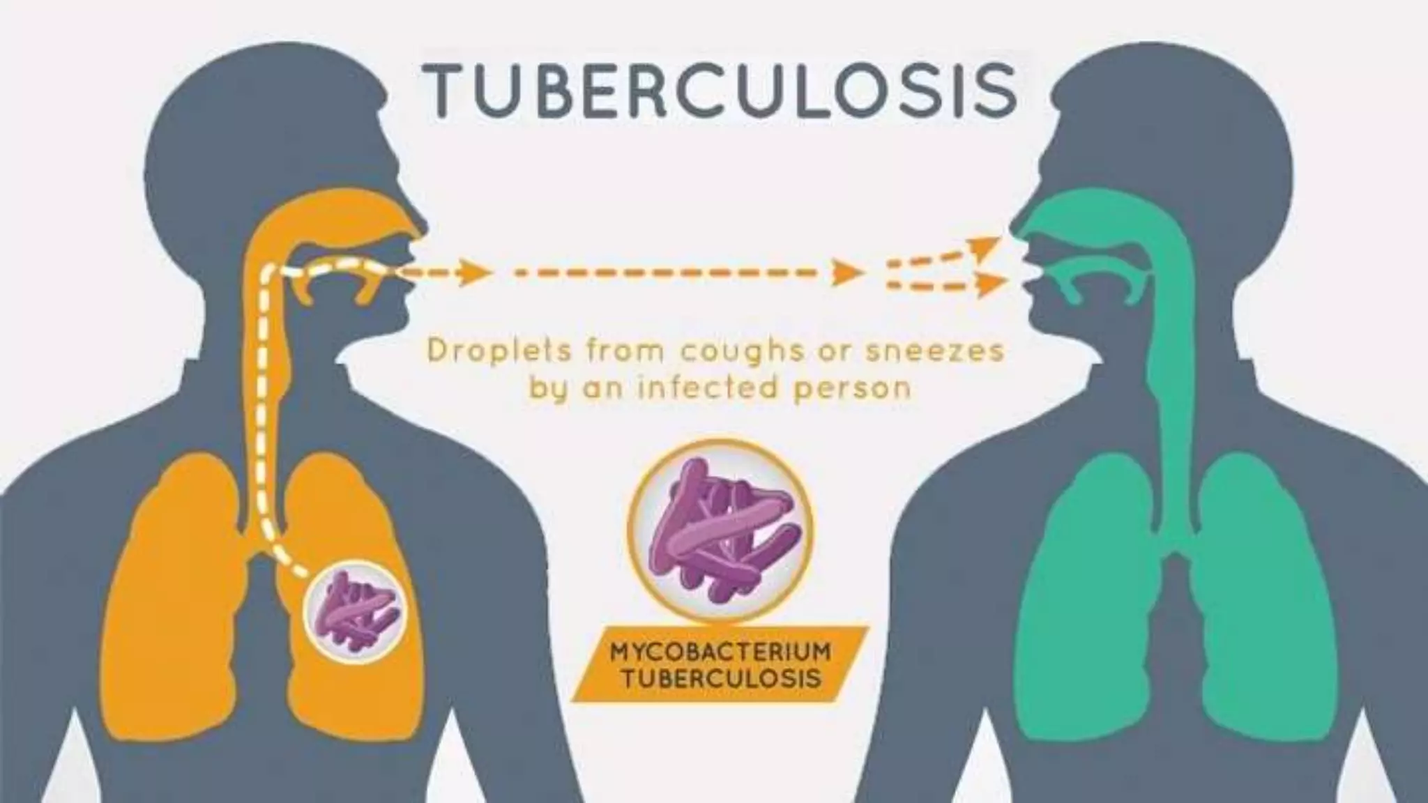 Pulmonary TB (Tuberculosis) PPT SlideShare | PPTX