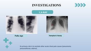 PULMONARY THROMBO EMBOLISM.pptx final.pptx thursday.pptx
