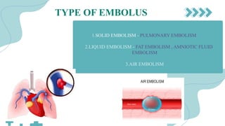 PULMONARY THROMBO EMBOLISM.pptx final.pptx thursday.pptx