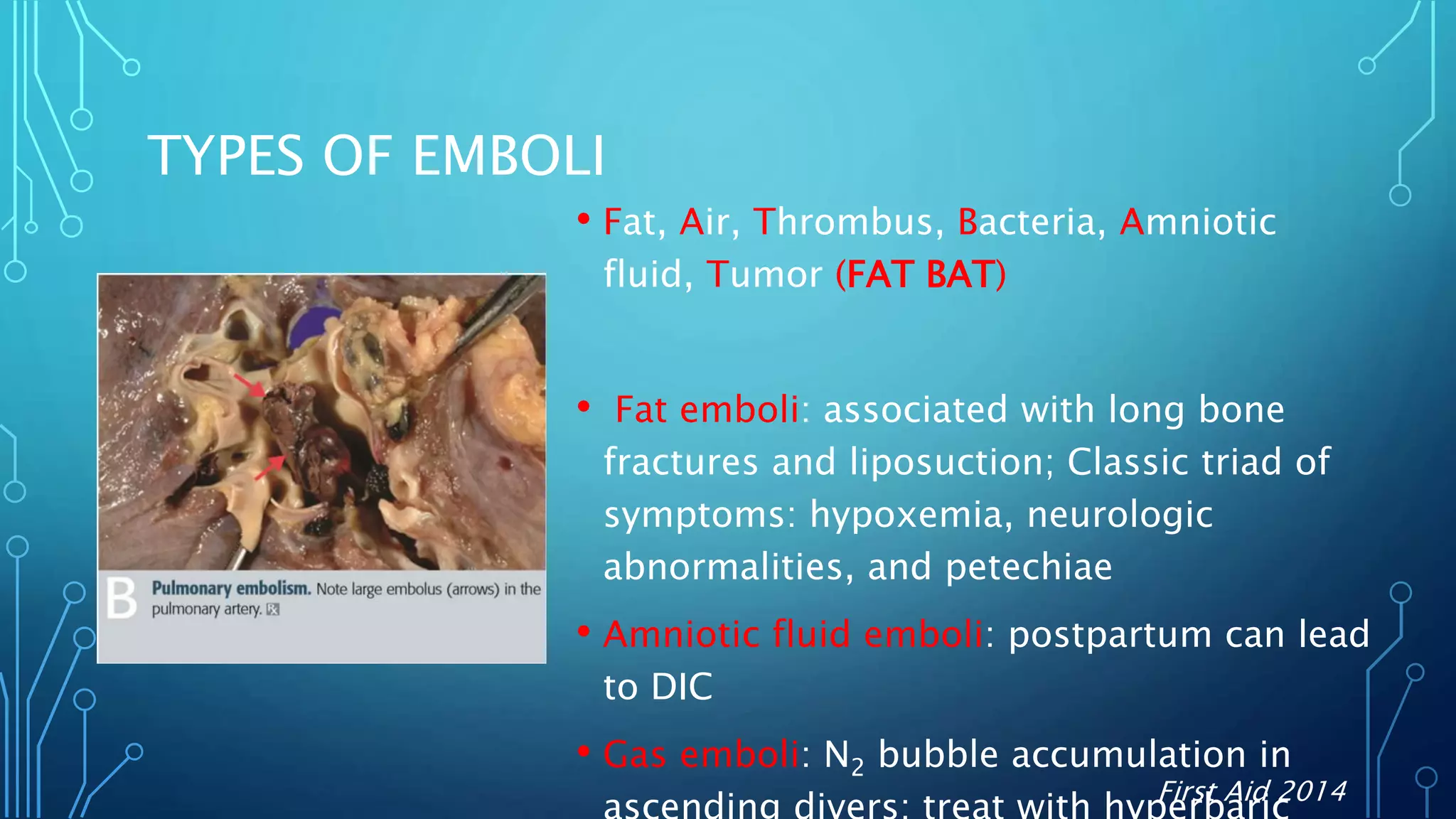 Pulmonary thromboembolism | PPTX