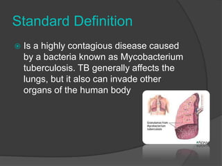 Pulmonary tuberculosis | PPTX