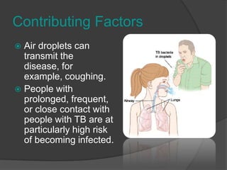 Pulmonary tuberculosis | PPTX