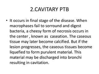 Pulmonary tuberculosis | PPTX