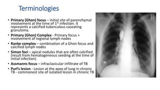 Pulmonary tuberculosis | PPTX