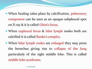 Pulmonary tuberculosis | PPTX