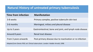 Pulmonary Tuberculosis.pptx