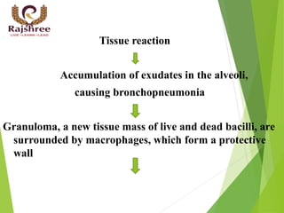 PULMONARY TUBERCULOSIS health care setting nursing perspective.pptx
