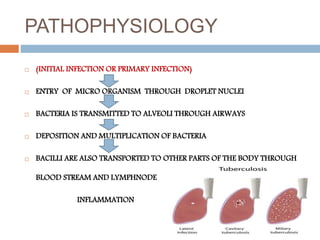 Extrapulmonary Tuberculosis Pathogenesis