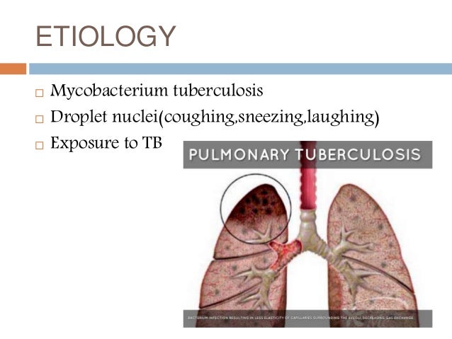 Pulmonary tuberculosis (tb)