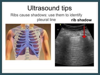 Pulmonary USS- Hamisi Mkindi.pptx