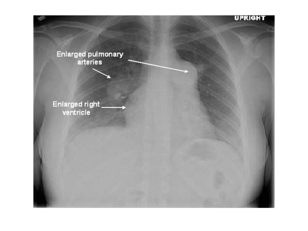 Diagnostic Imaging of Pulmonary Vasculature
