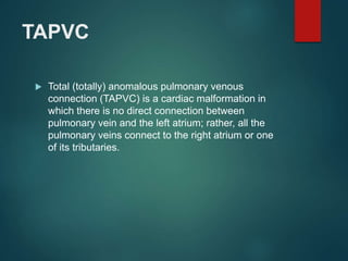 PULMONARY VENOUS ANOMALIES by Dr reyaz fayaz | PPTX | Heart and ...