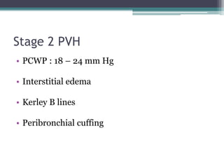 Pulmonary venous hypertension stages & skiagraphic changes | PPTX