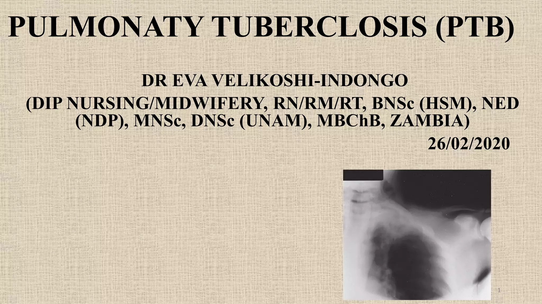 Pulmonaty Tuberclosis ((PTB) | PDF