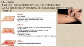 Pulmonaty Tuberclosis ((PTB) | PDF | Lung and Respiratory Health ...