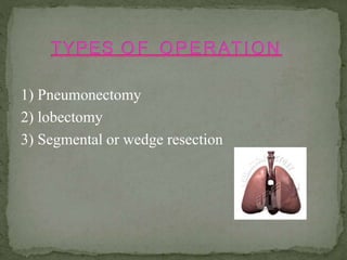 Pulmonery surgery | PPTX