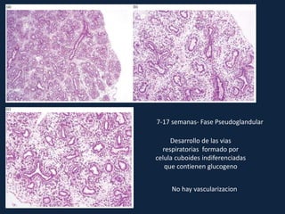 Histología Pulmonar Normal