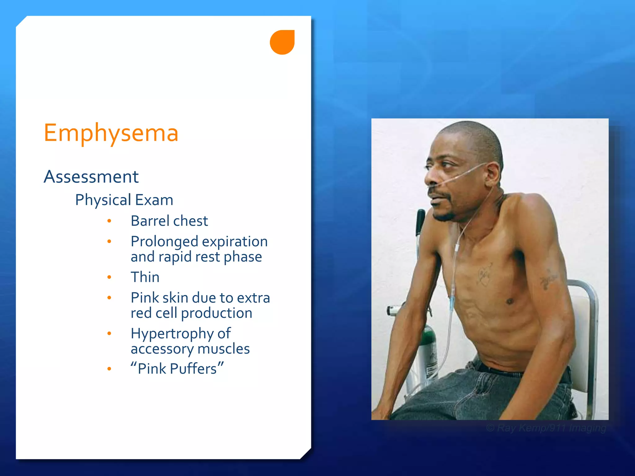 Pulmonology part 2 resp diseases | PPTX