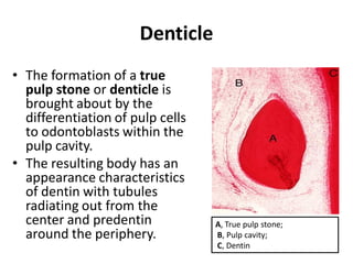 Pulp | PDF | Dental Health | Diseases and Conditions