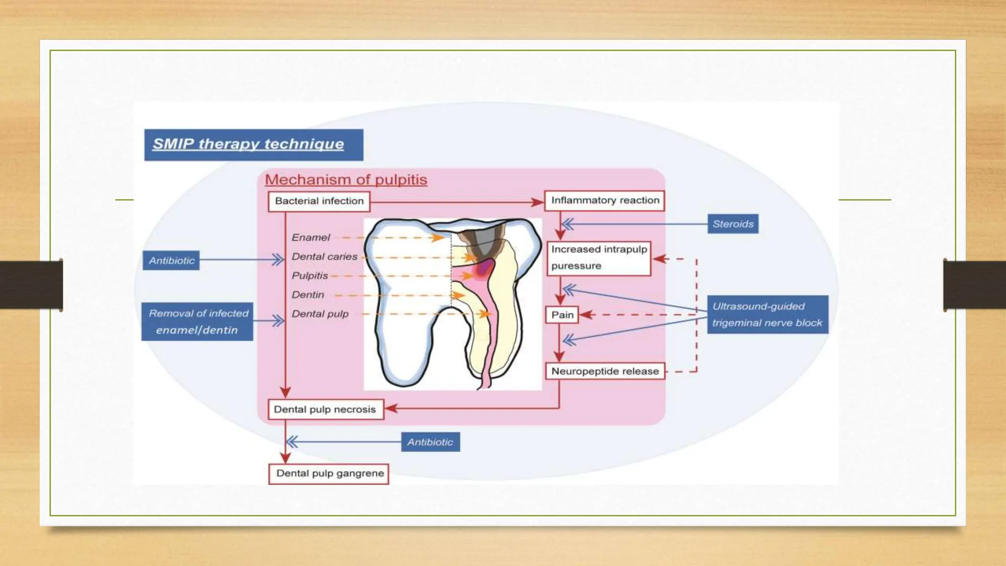 PULP and it's histology ,zones ,cells ,age changes and clinical ...