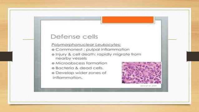 PULP and it's histology ,zones ,cells ,age changes and clinical ...