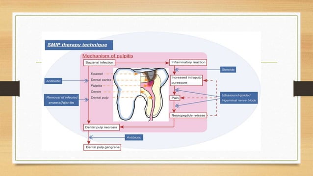 PULP and it's histology ,zones ,cells ,age changes and clinical ...