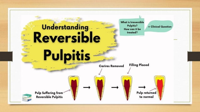 PULP and it's histology ,zones ,cells ,age changes and clinical ...
