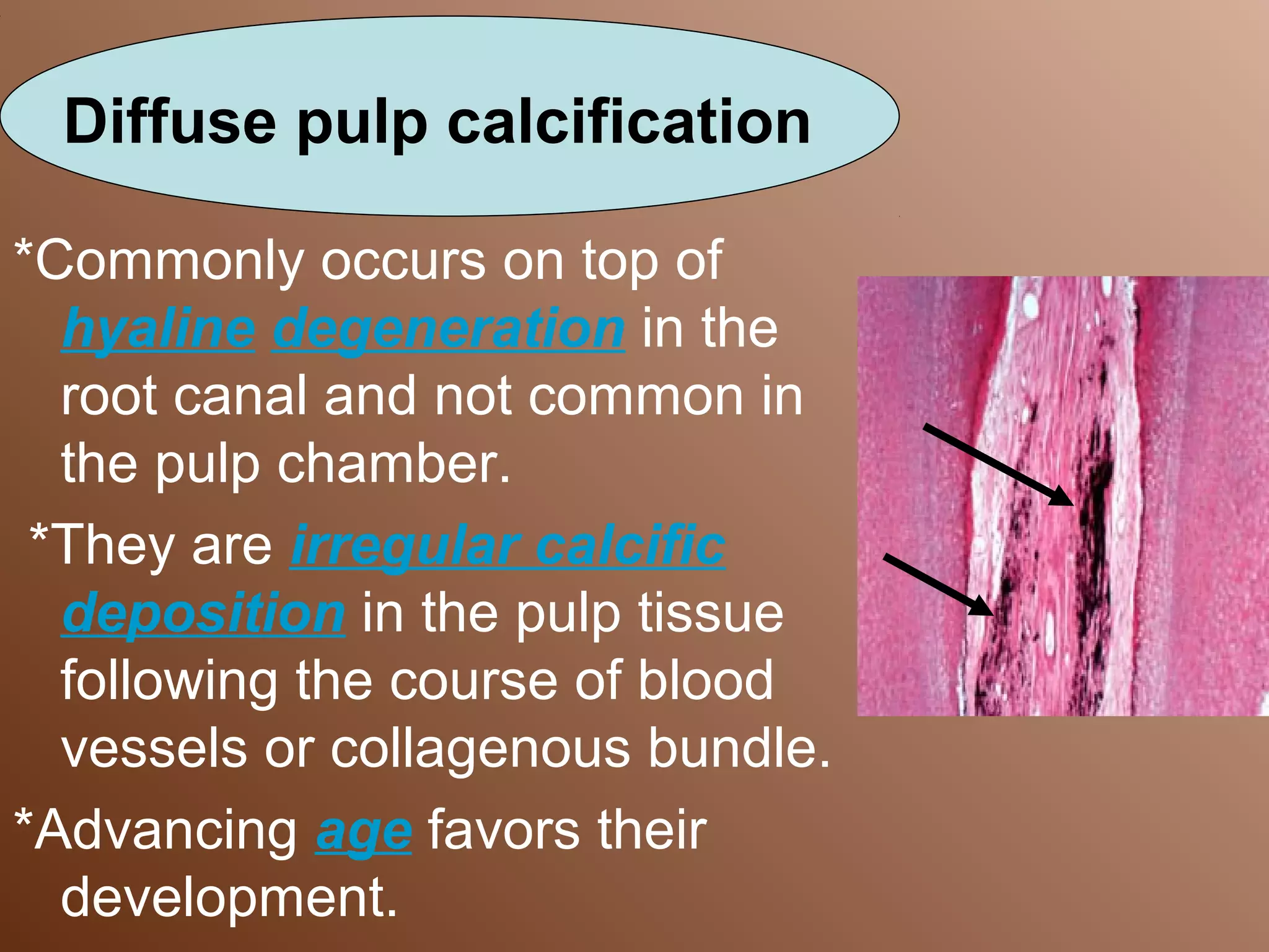 Pulp | PPT