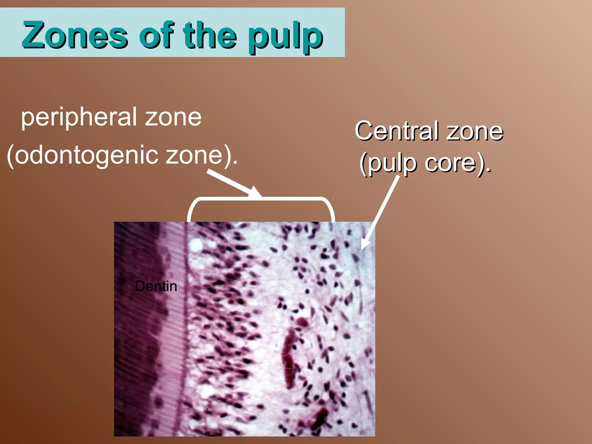 Pulp | PPT