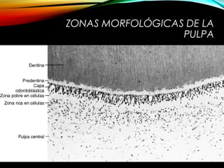 Pulpa dental | PPT