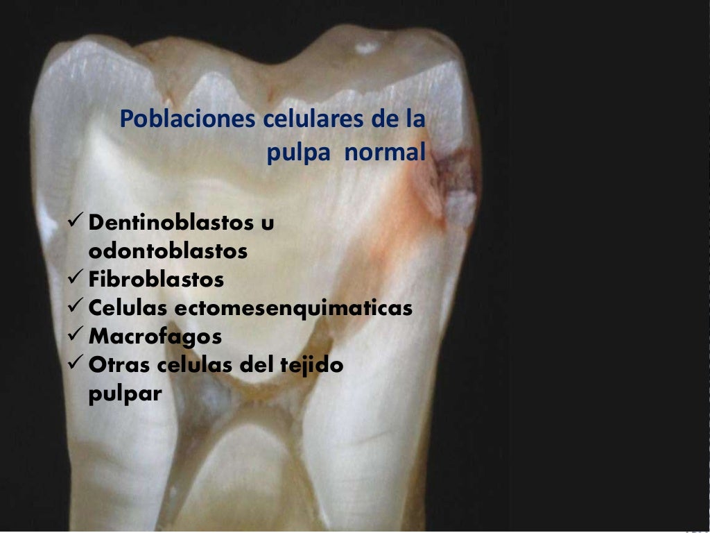 Pulpa dental