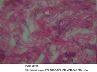 Pulpa dental, consideraciones | PPTX