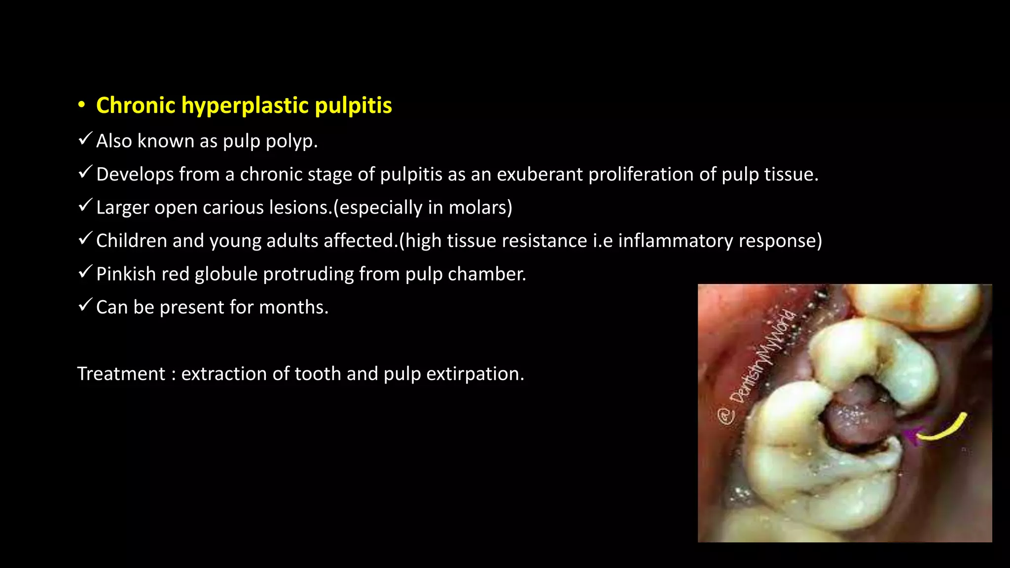 pulpal and periapical lesions.pptx