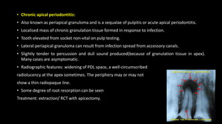pulpal and periapical lesions.pptx