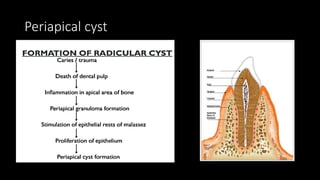 pulpal and periapical lesions.pptx