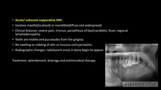pulpal and periapical lesions.pptx
