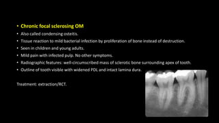 pulpal and periapical lesions.pptx