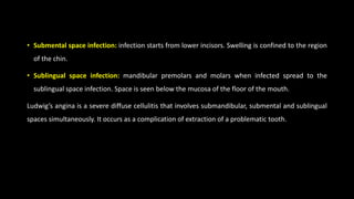 pulpal and periapical lesions.pptx